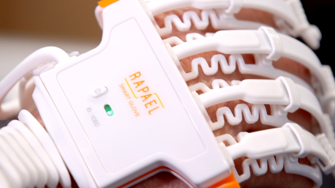 This smart glove turns physical therapy into a game - Video - Tech This smart glove turns physical therapy into a game - Video - Tech